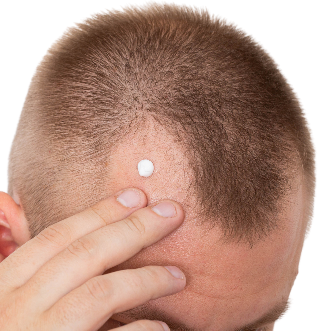 LéhCär Aesthetics Hair Restoration - LéhCär Aesthetics